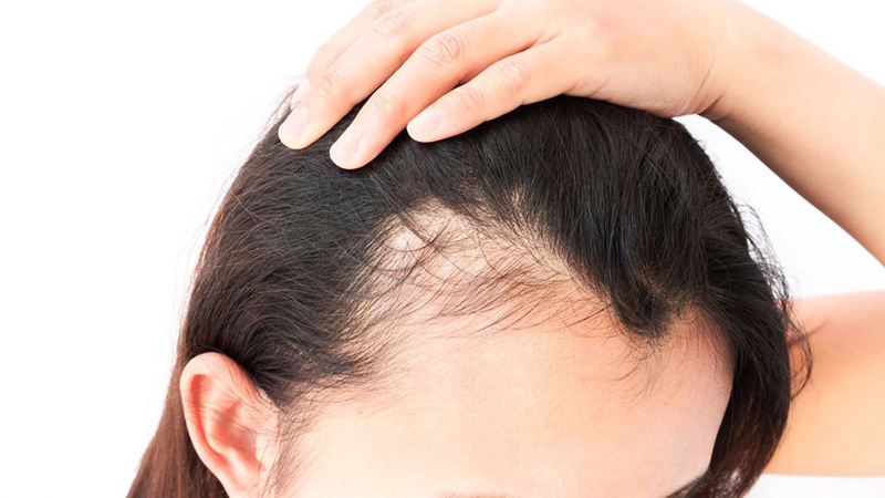 Cabelo Ralo e Fino: Dicas para Engrossar e Fortalecer os Fios